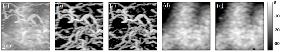 Deep Unfolded Robust Pca With Application To Clutter Suppression In